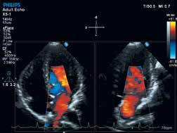 飞利浦彩超EPIQ7C PHILIPS EPIQ 7C心脏超声_报价/价格/性能参数/图, 飞利浦/PHILIPS_生物器材网