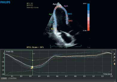 飞利浦彩超EPIQ7C PHILIPS EPIQ 7C心脏超声_报价/价格/性能参数/图, 飞利浦/PHILIPS_生物器材网