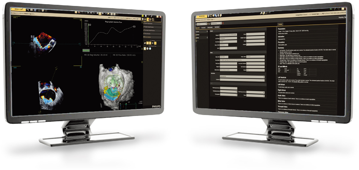 飞利浦心脏彩超EPIQ CVx PHILIPS EPIQ CVxi_报价/价格/性能参数/图, 飞利浦/PHILIPS_生物器材网